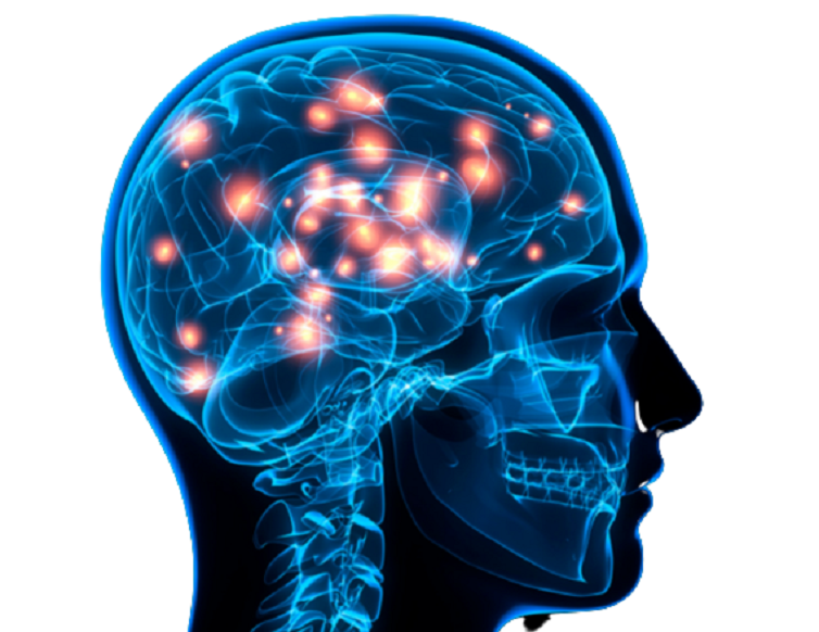 Neurology | ODE | REWIND | RCGP Learning
